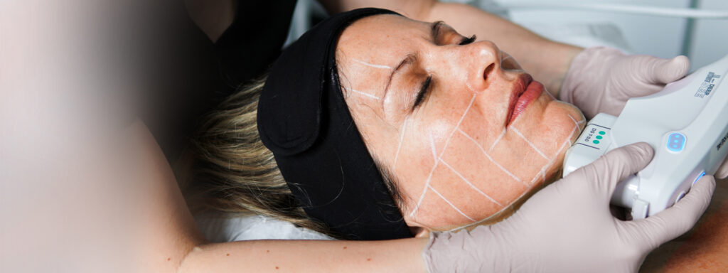 Offre de soins esthétiques sans chirurgie à Montréal et au Québec | Dermapure