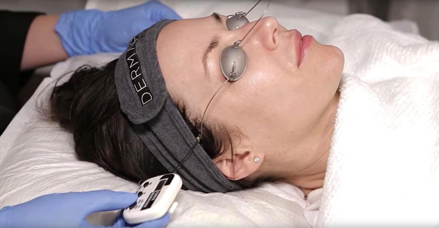 Peeling à l'Acide Glycolique Saint-Lambert | Dermapure