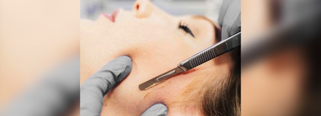 Traitement de la couperose et de la rosacée | Dermapure