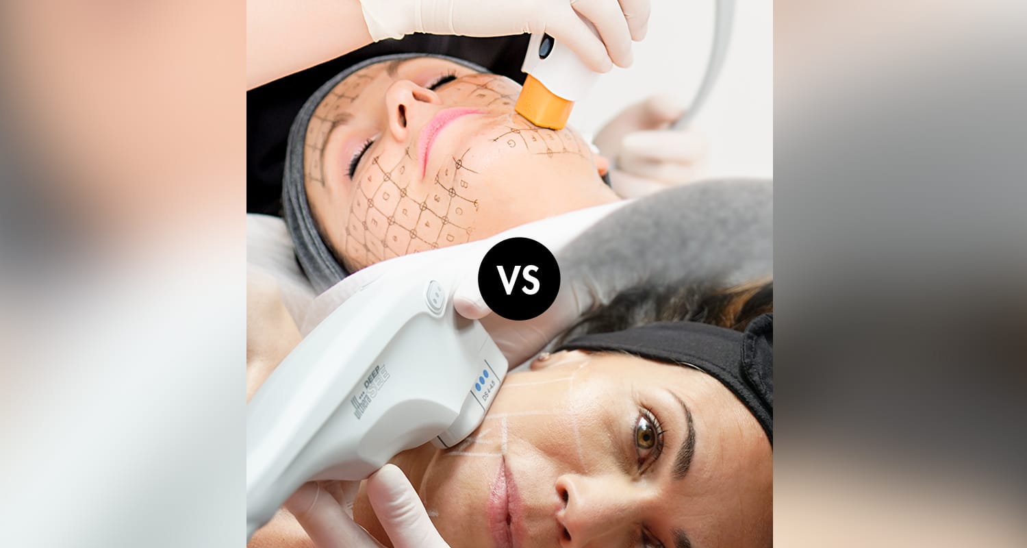 Thermage vs. Ultherapy: Which One Is Better For You?